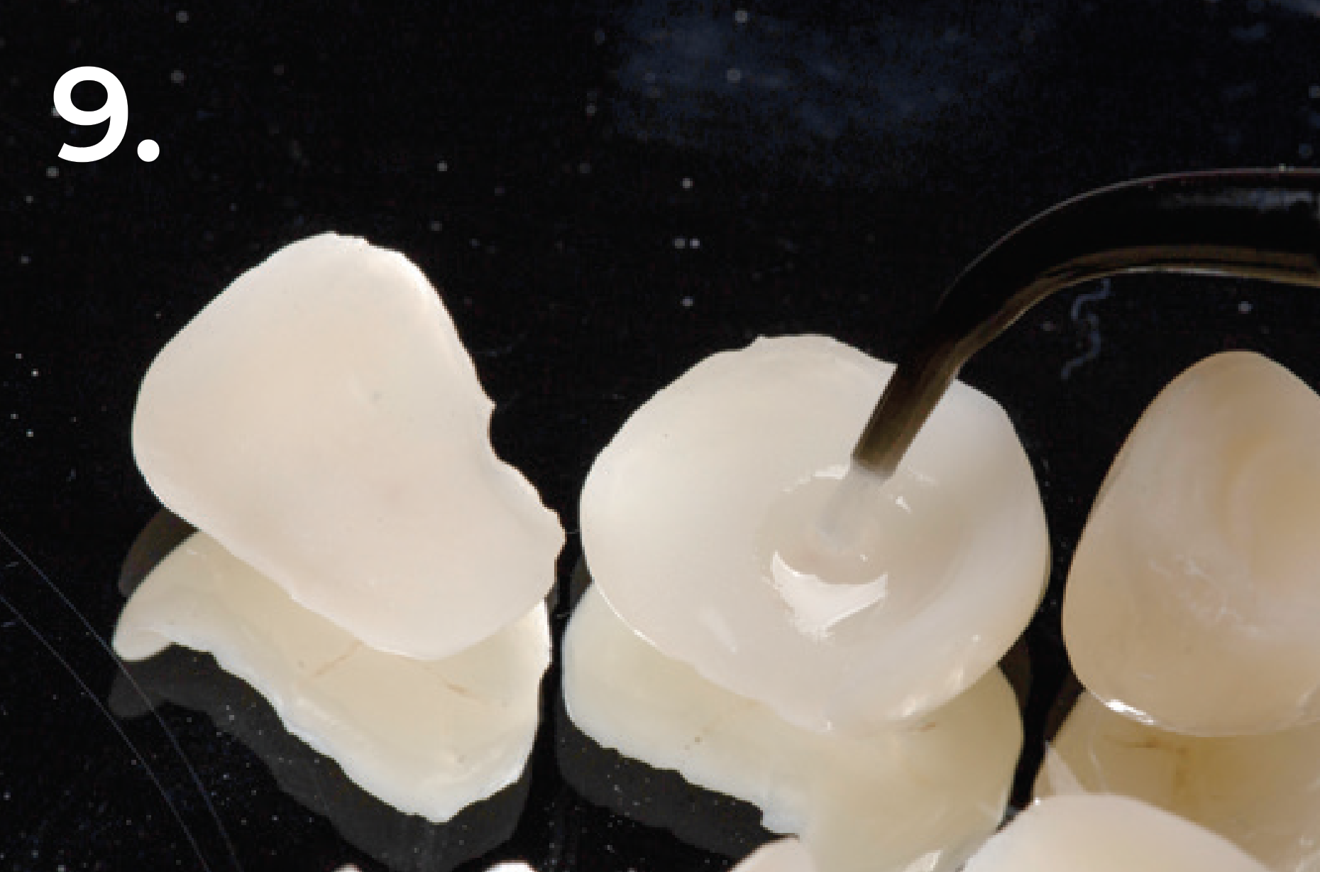 Guía Clínica de FORMA: Resina compuesta nanohíbrida con zirconia